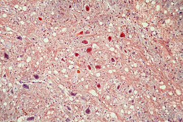 Brain cells tissue stock image. Image of medicine, nerve - 196729993