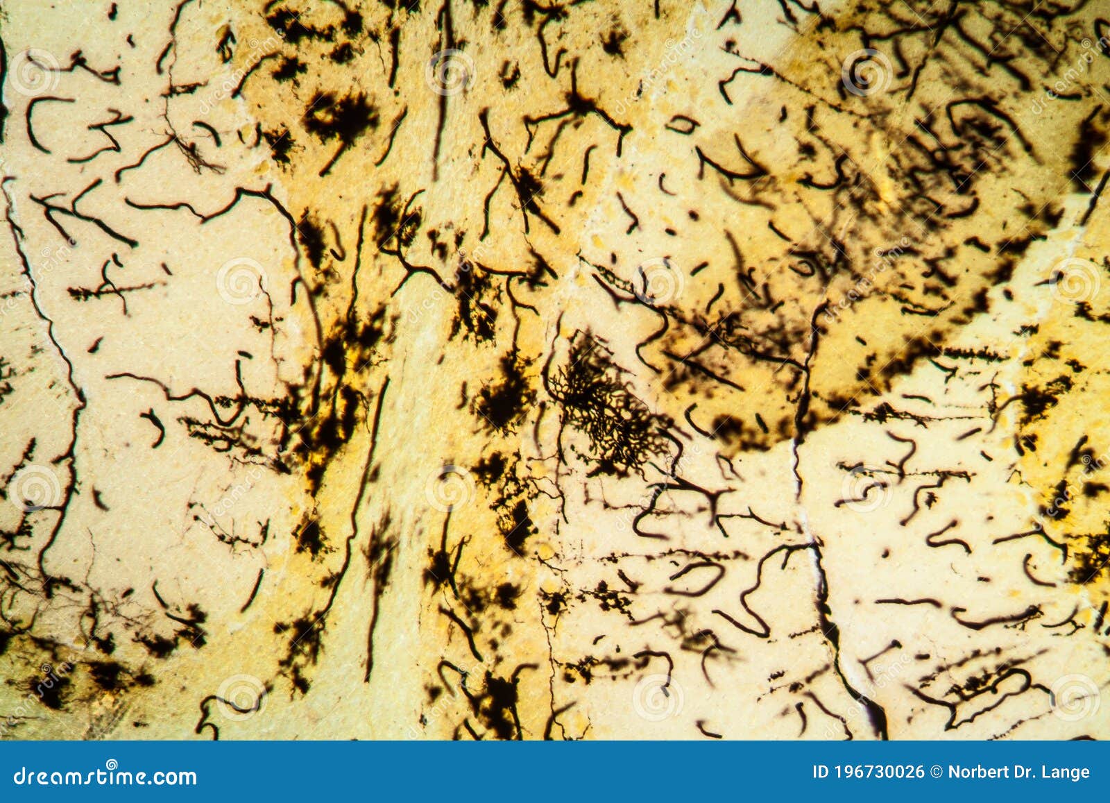 Brain cells tissue stock photo. Image of cells, magnifying - 196730026