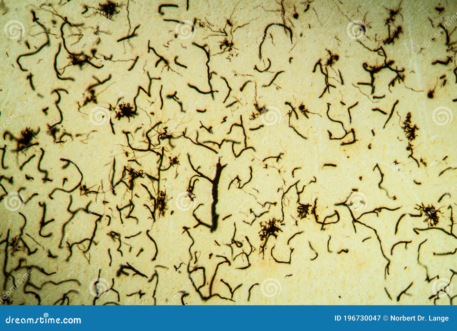 Brain cells tissue stock image. Image of magnifying - 196730047