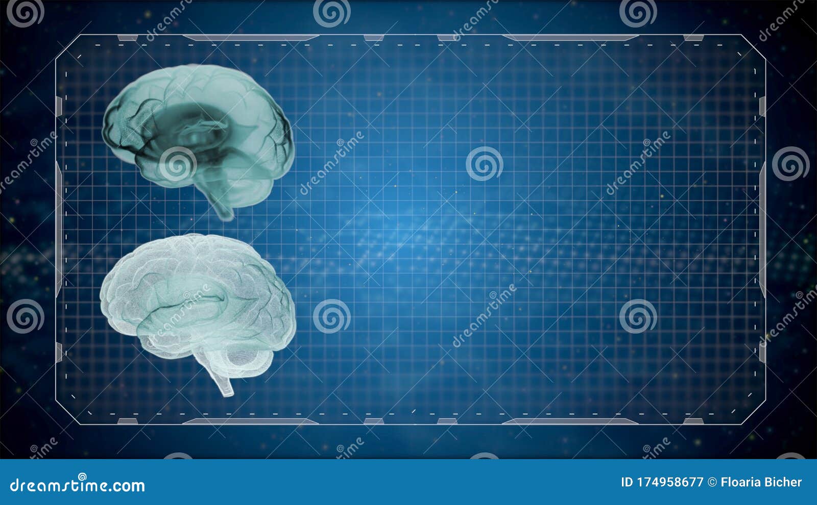3d Render Computed Medical Tomography MRI Scan Of Human Brain Over ...