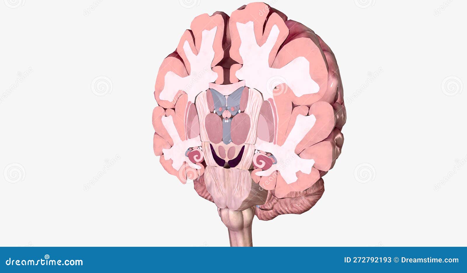 MRI Brain Coronal T2W Plane For Detect Stroke Disease . Royalty-Free ...