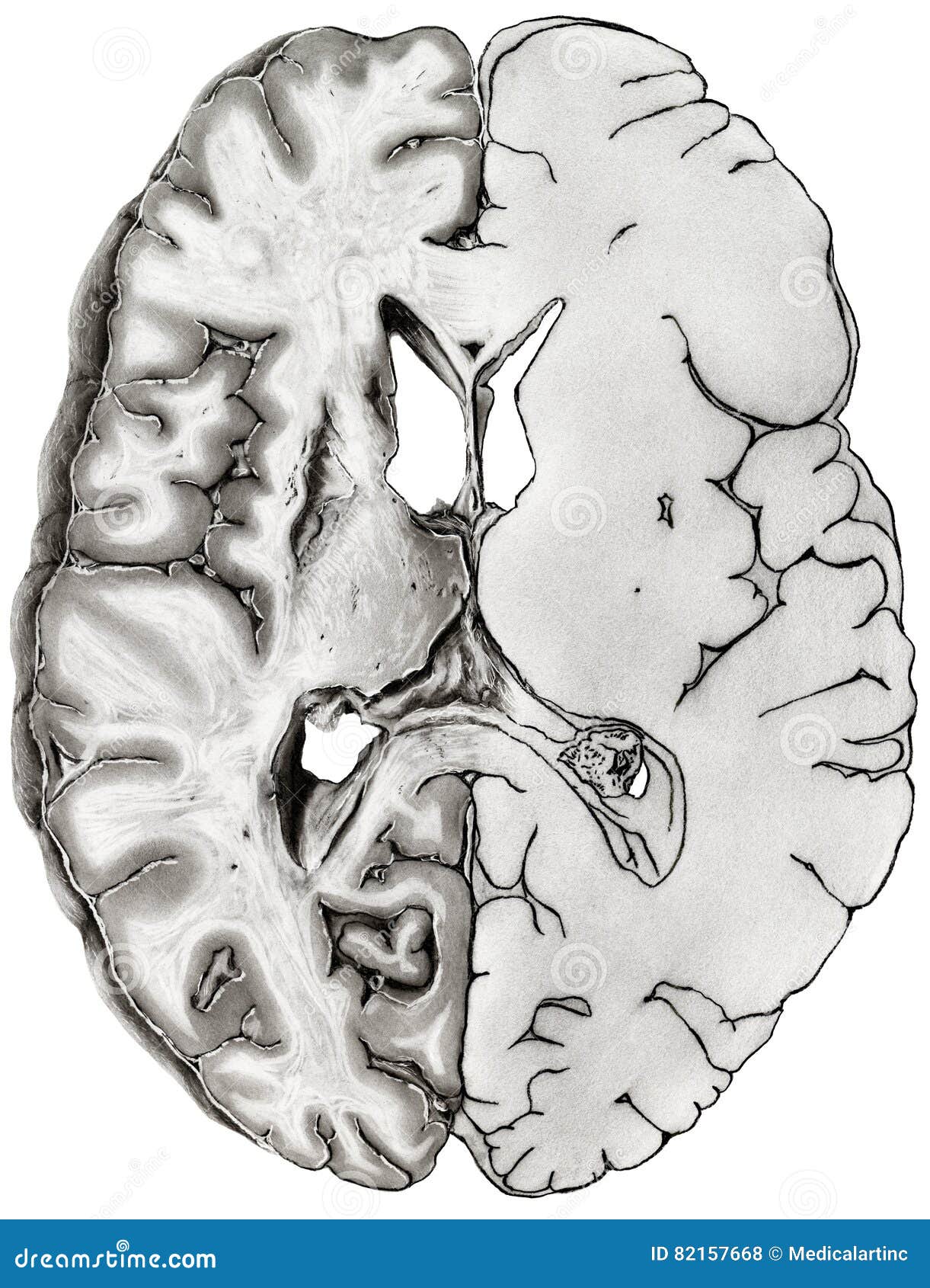 Brain - Cross Section stock illustration. Illustration of brain - 82157668