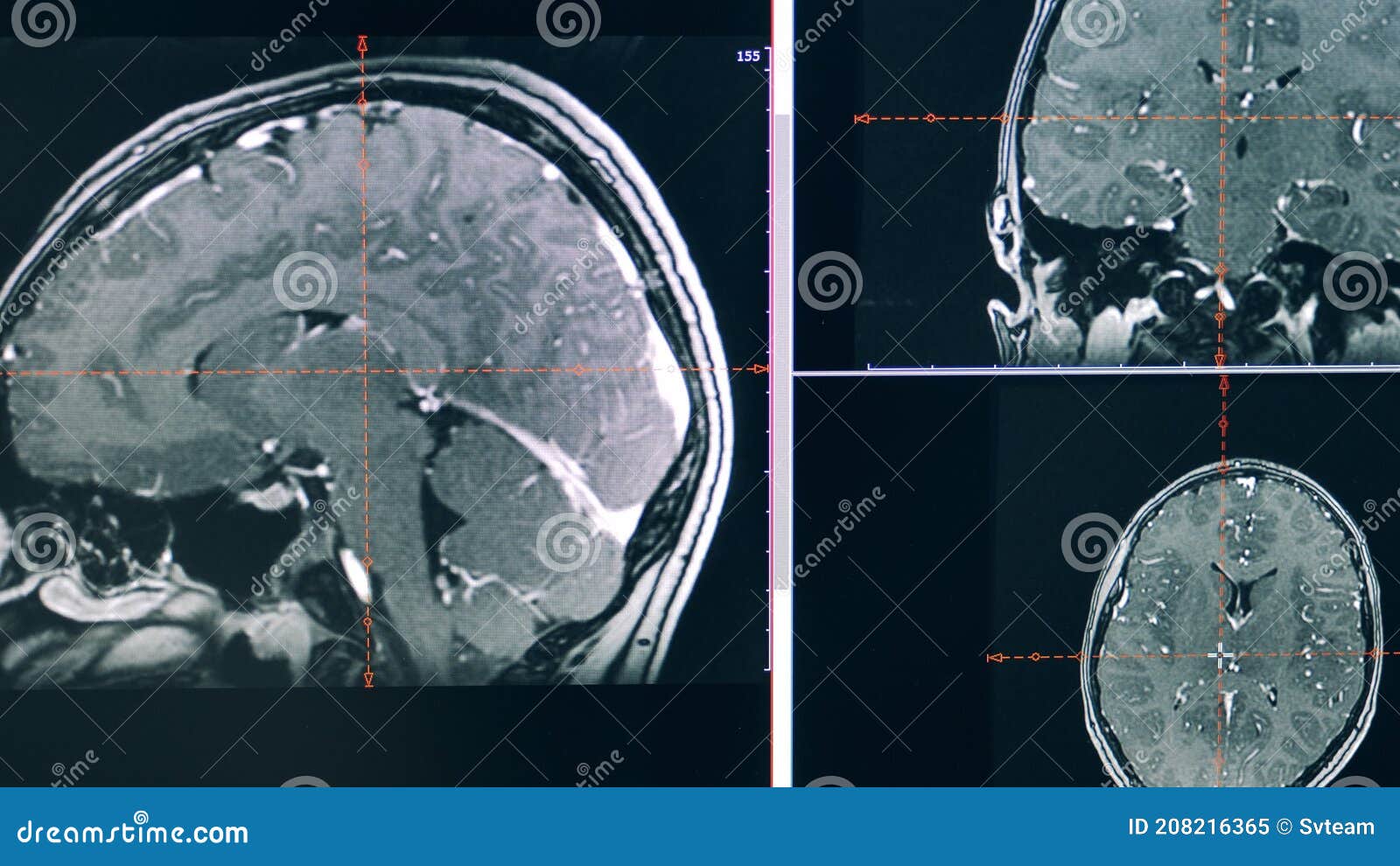 Brain CT Scans on the Computer Display Stock Video - Video of ...