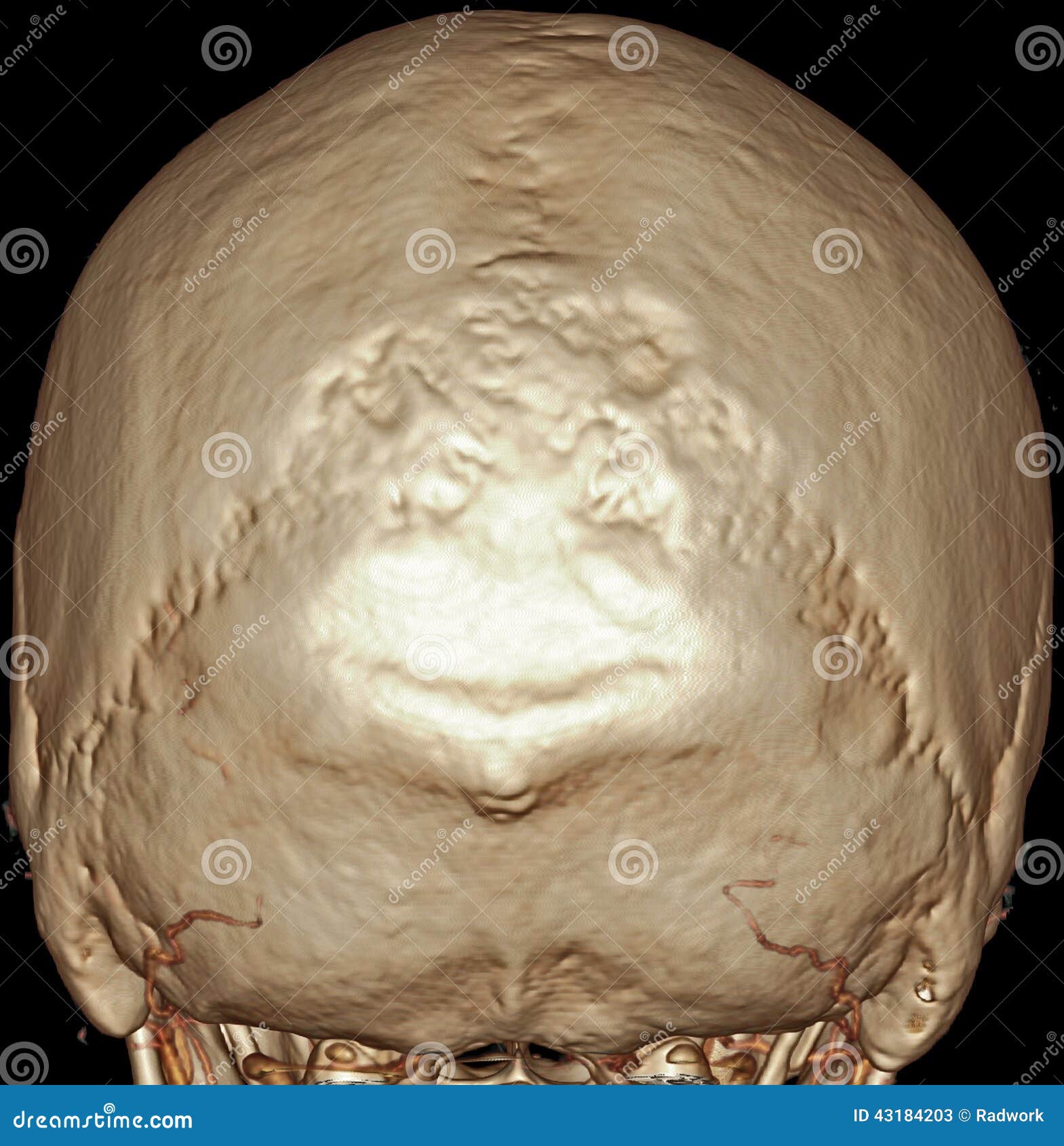 Brain 3D CT stock illustration. Illustration of brain - 43184203