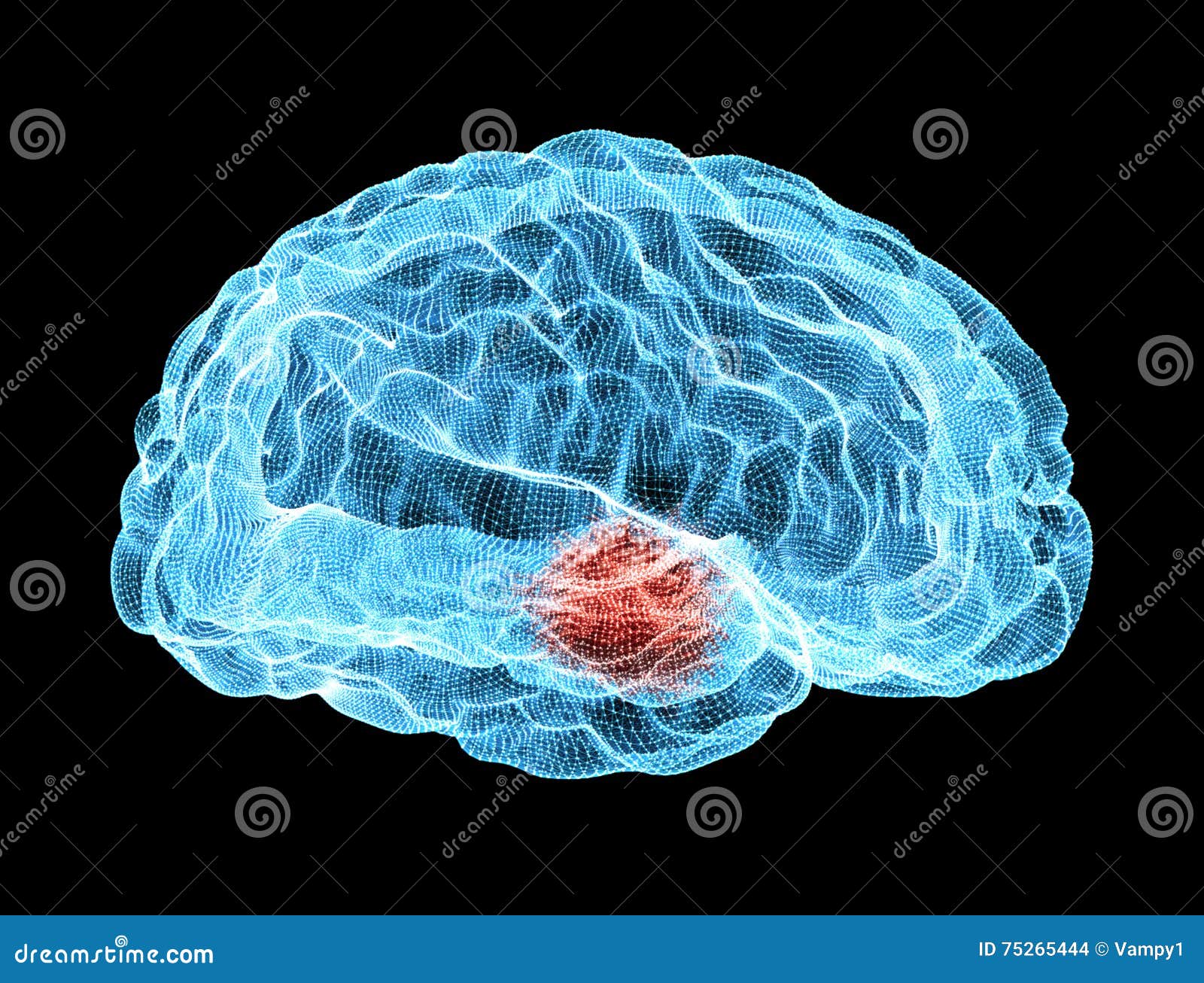 Brain Degenerative Diseases, Parkinson S, Body, Face Stock Illustration ...