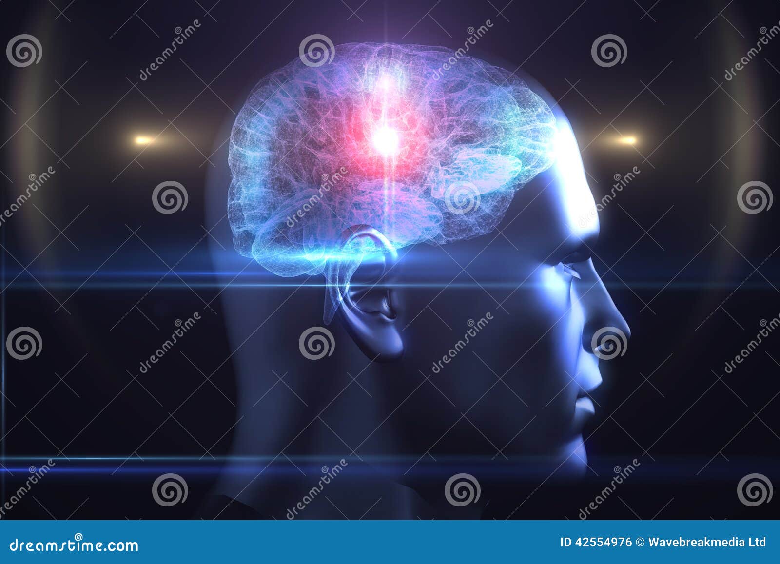 A Brain Diagram Highlighting An Area Of Stored Memories That Has Become ...