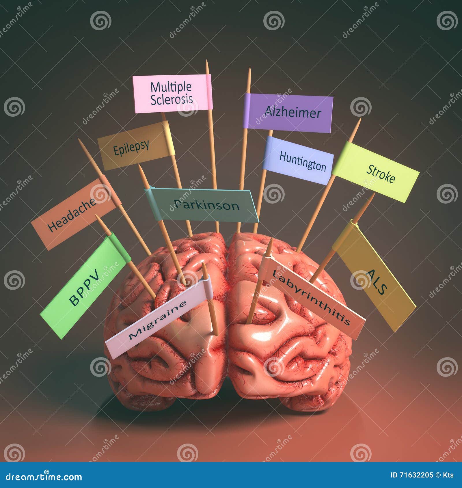 Brain Diseases illustration stock. Illustration du recherche - 71632205