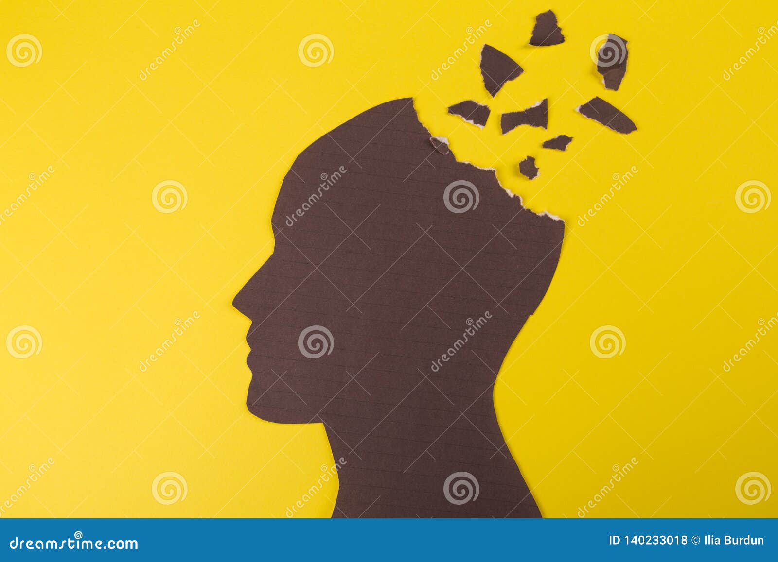 Alzheimer, Dementia Symptoms Infographic, Old Man With Memory Loss And ... Alzheimer, Dementia Symptoms Infographic, Old Man With Memory Loss And ...
