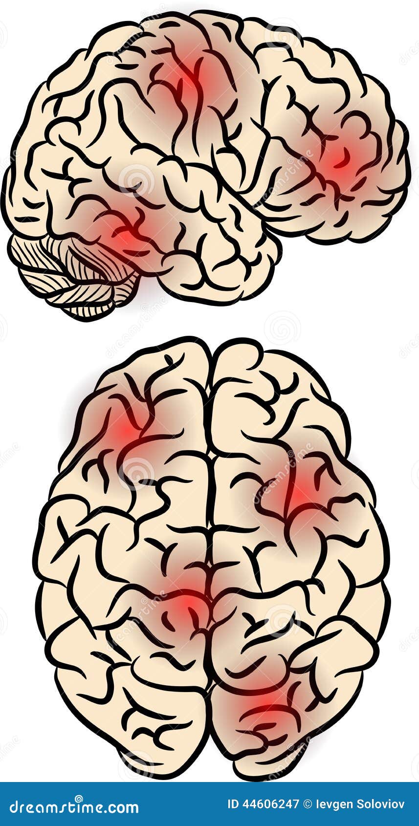 Brain fever stock illustration. Illustration of inspiration - 44606247