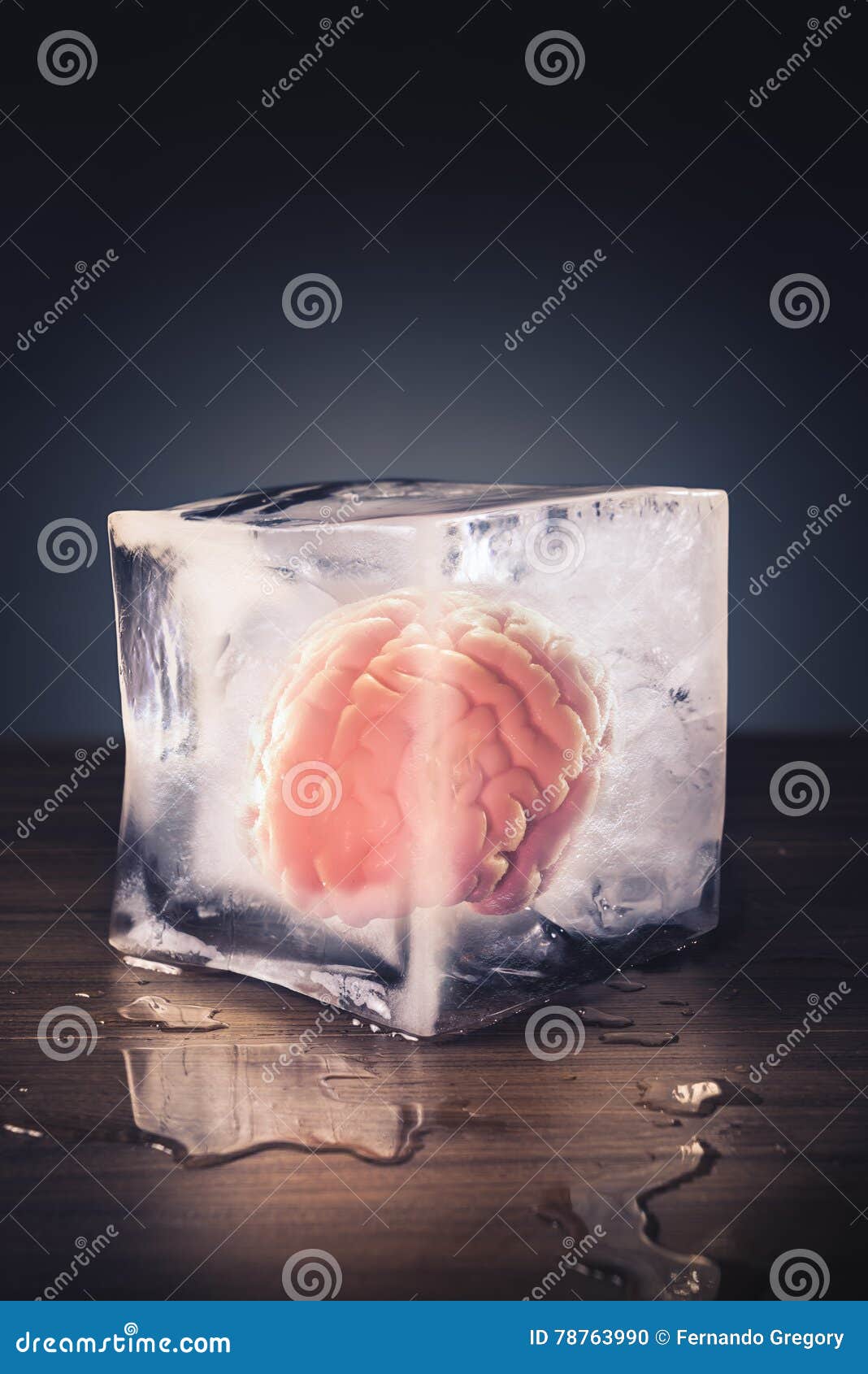 Frozen Brain Cryogenic Concept. Cerebellum. Human Brain Freeze 3D ...