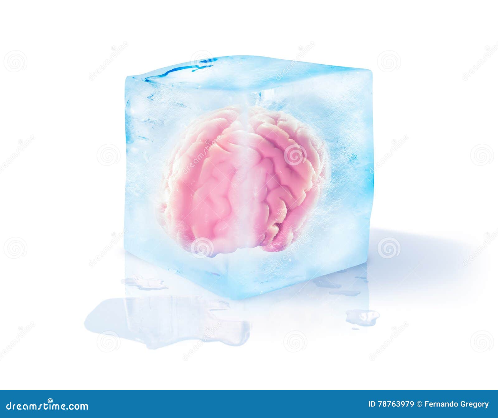Frozen Brain Cryogenic Concept. Cerebellum. Human Brain Freeze 3D ...