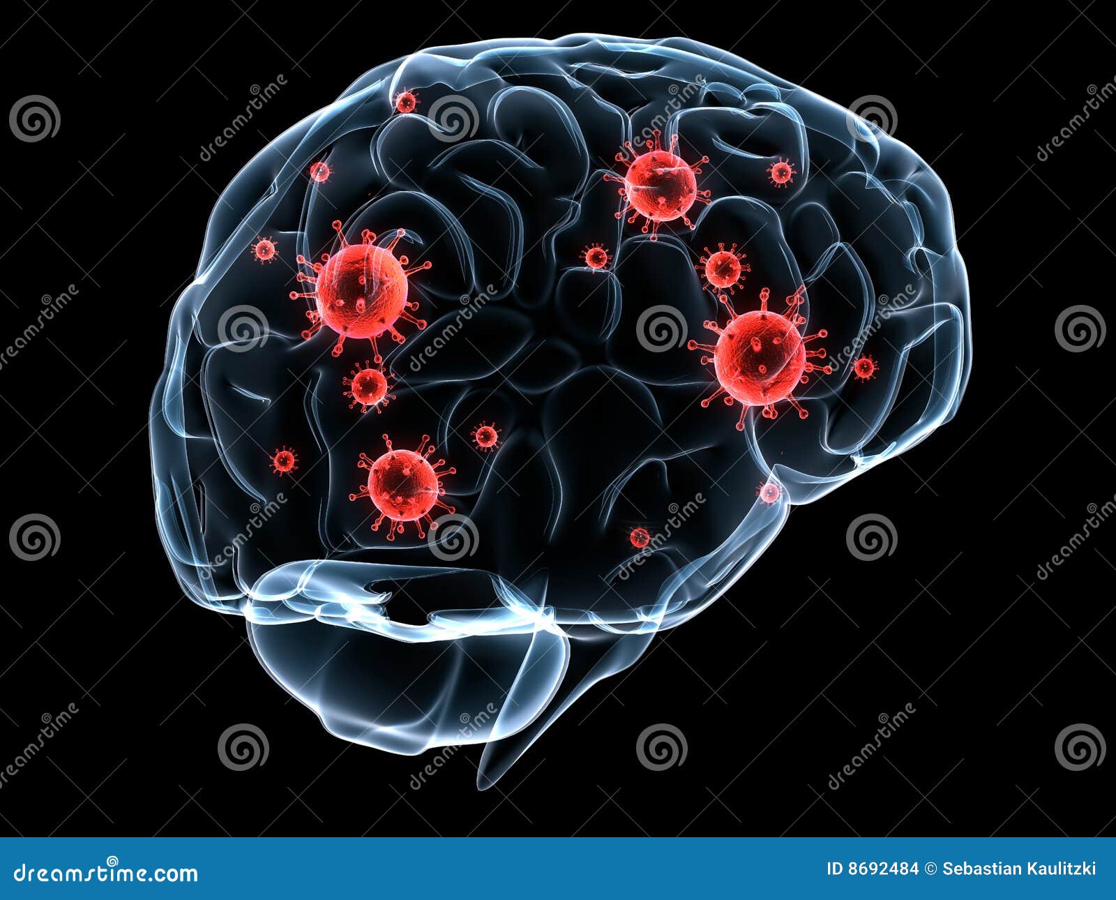 Brain infection stock illustration. Illustration of disease - 8692484