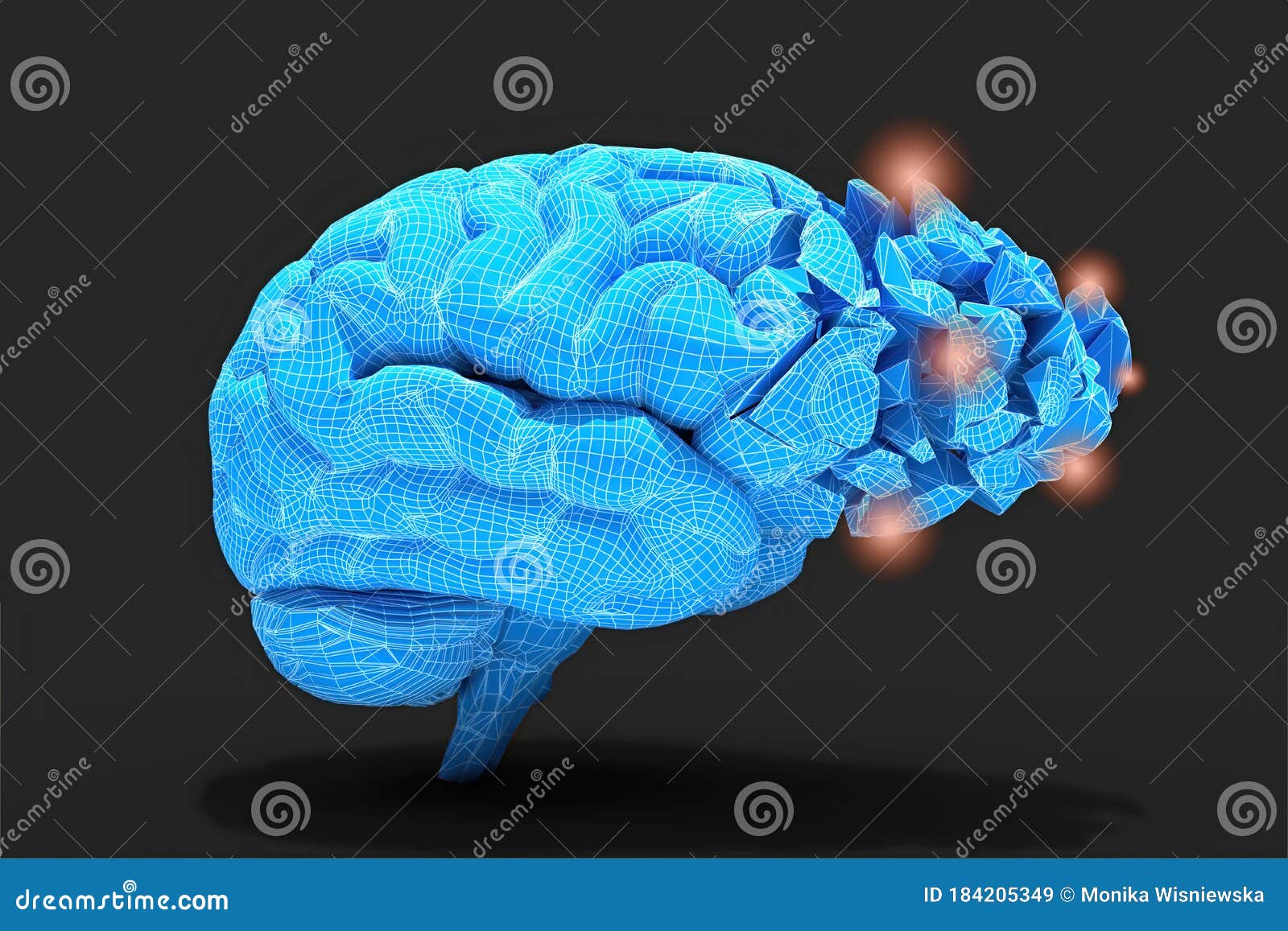 Brain Inflammation or Brain Disease Stock Illustration - Illustration ...