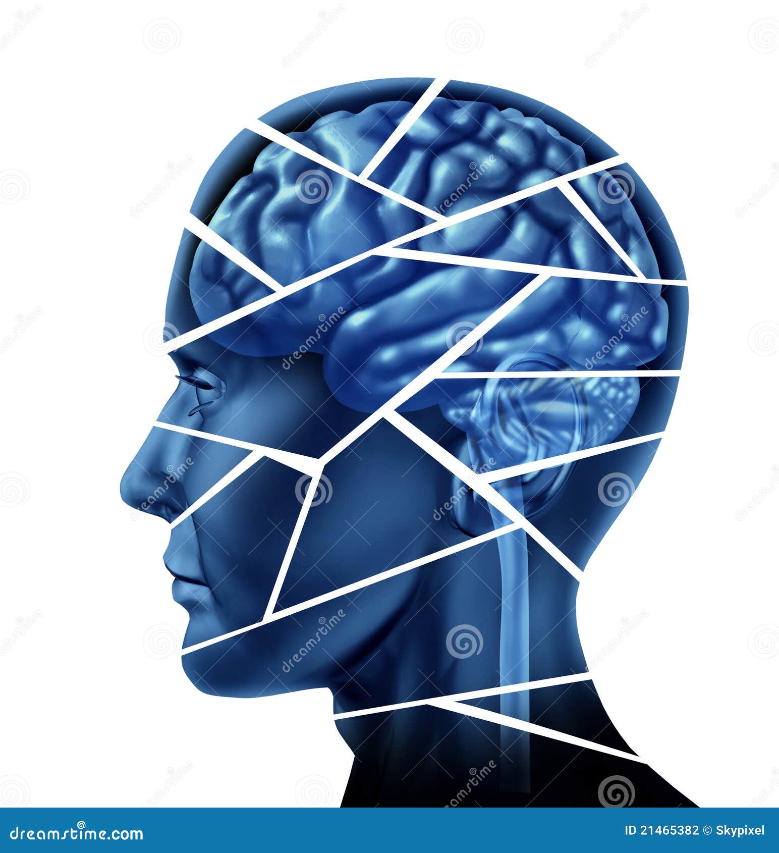 Brain Injury Stock Photography - Image: 21465382