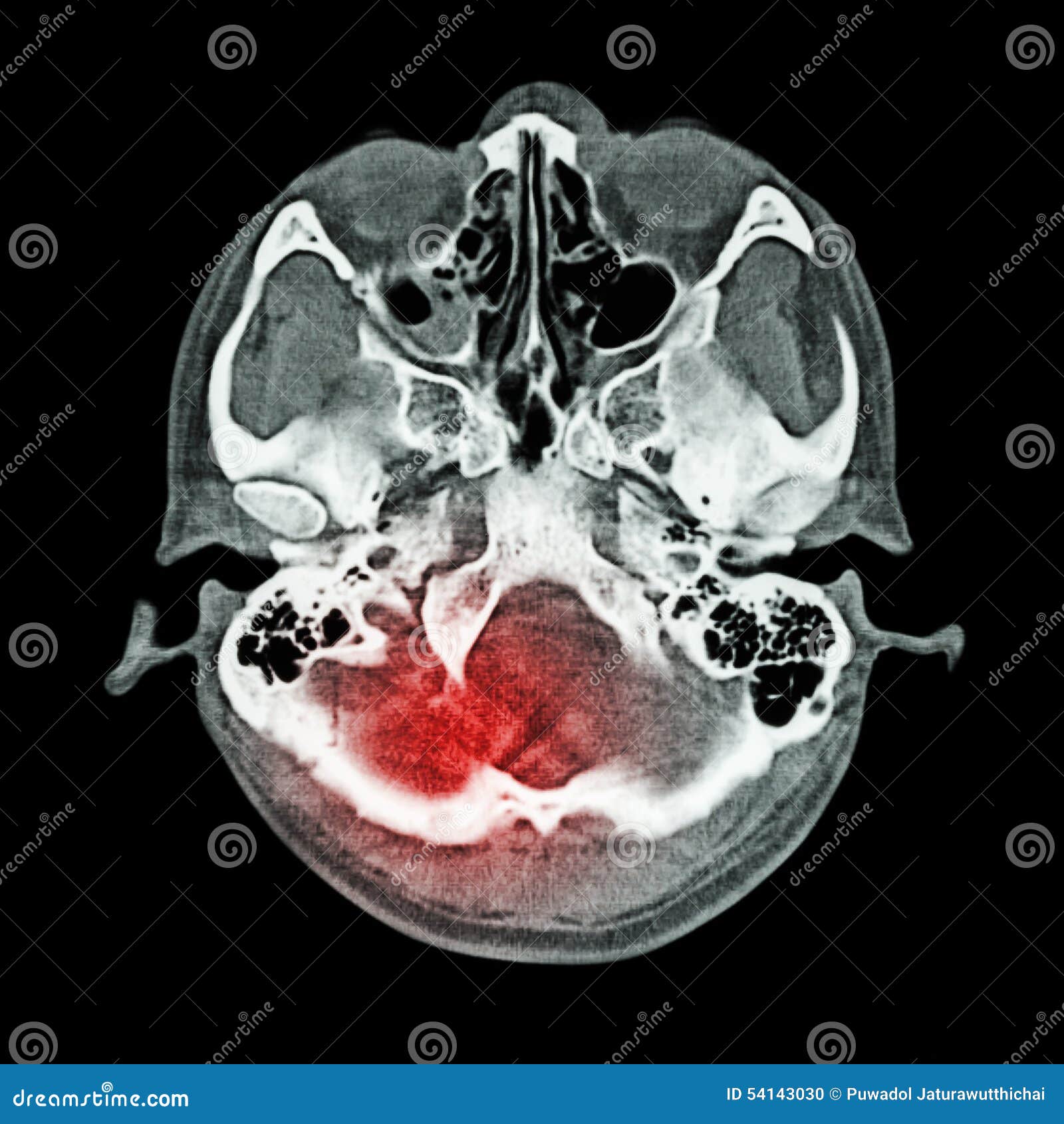 Skull Bone Anatomy Model Royalty-Free Stock Image | CartoonDealer.com ...