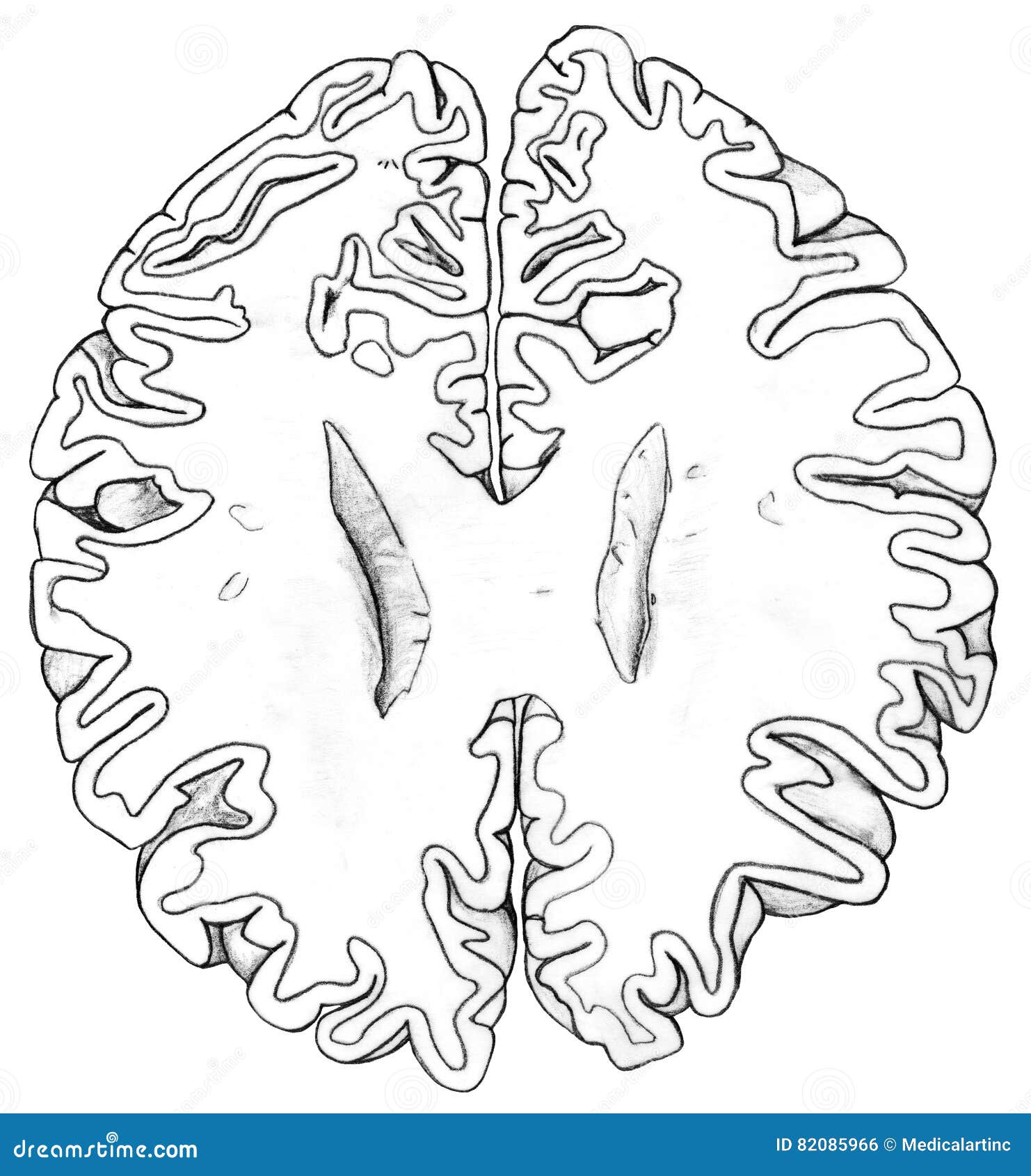Brain - Lower Region Cross Section Royalty-Free Stock Image ...