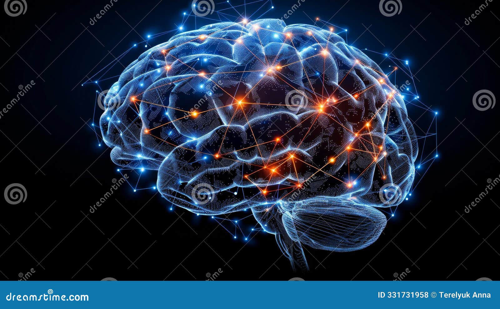 A Brain with Many Connections is Shown in a Blue and Orange Color ...