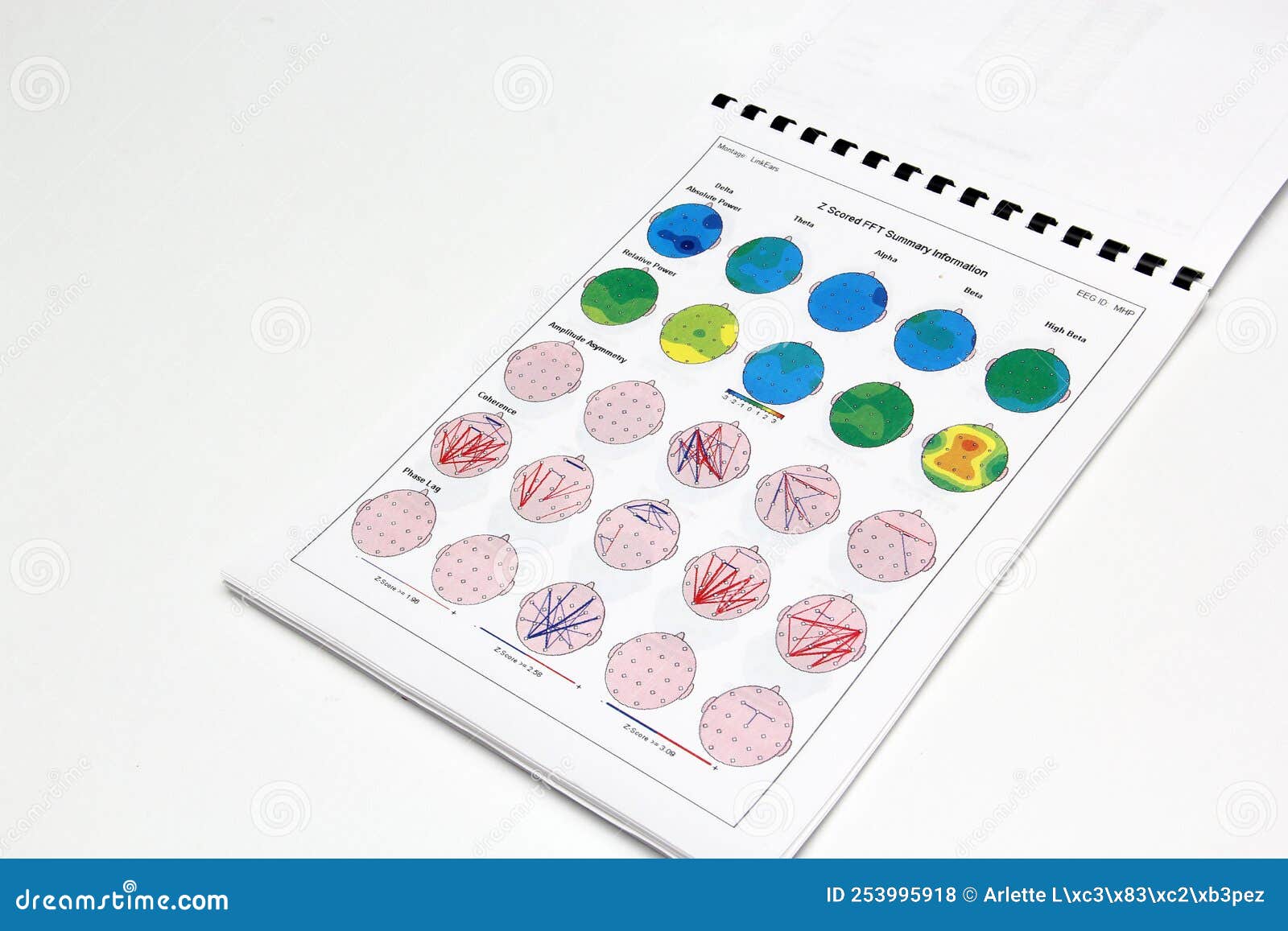 Brain Mapping Done by a Neurologist Doctor with Neuroscience Technique ...