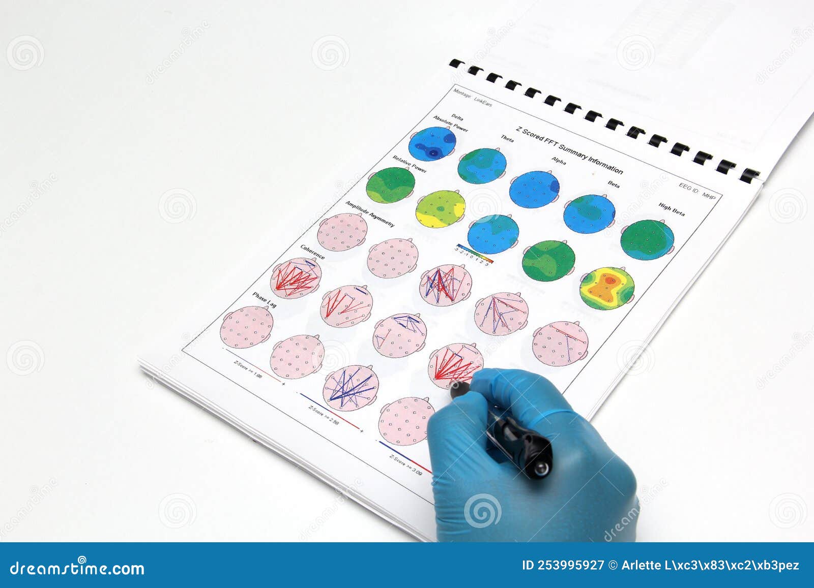 Brain Mapping Done by a Neurologist Doctor with Neuroscience Technique ...