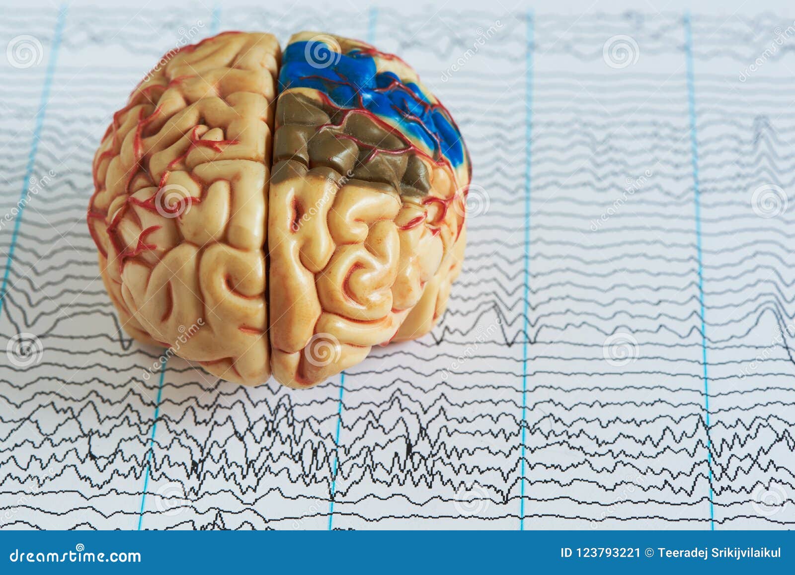Brain Model on Human Brain Wave Background Stock Image - Image of ...