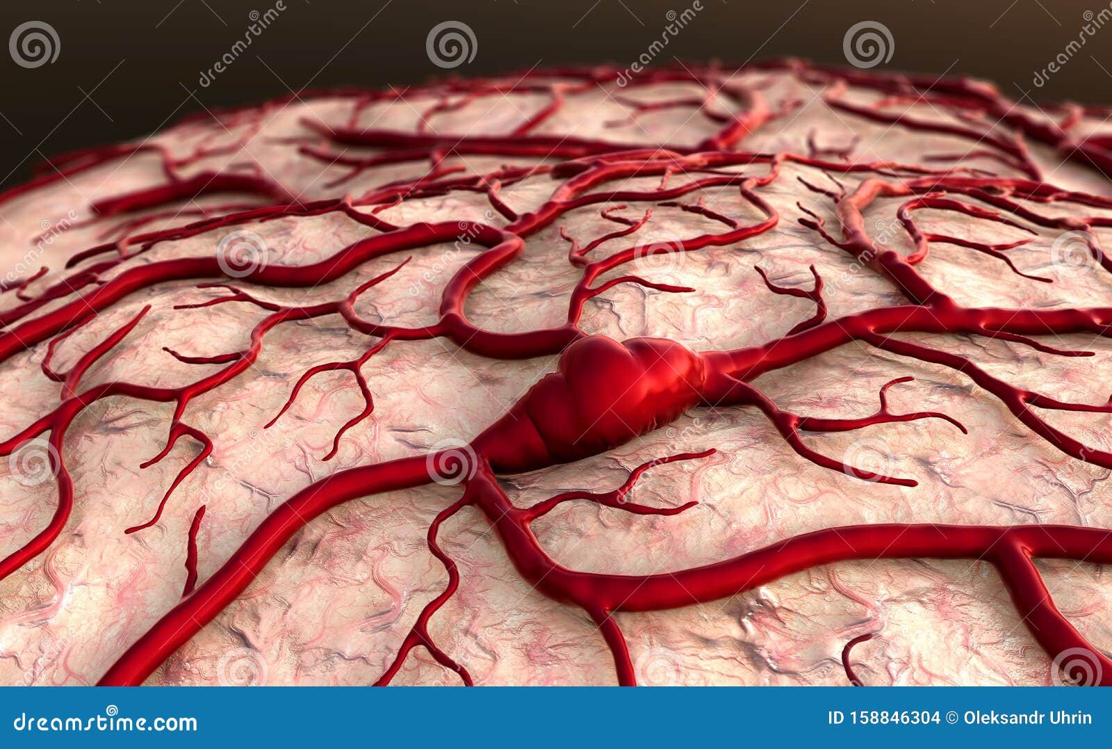 Insult, Capillaries on the Brain Stock Illustration - Illustration of ...