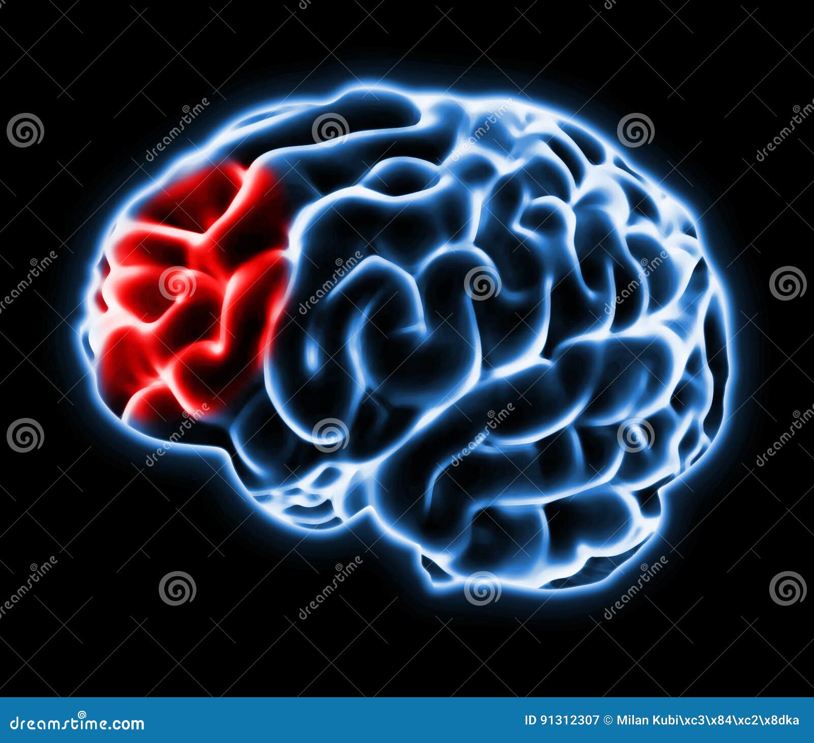 Brain pain illustration stock illustration. Illustration of ...