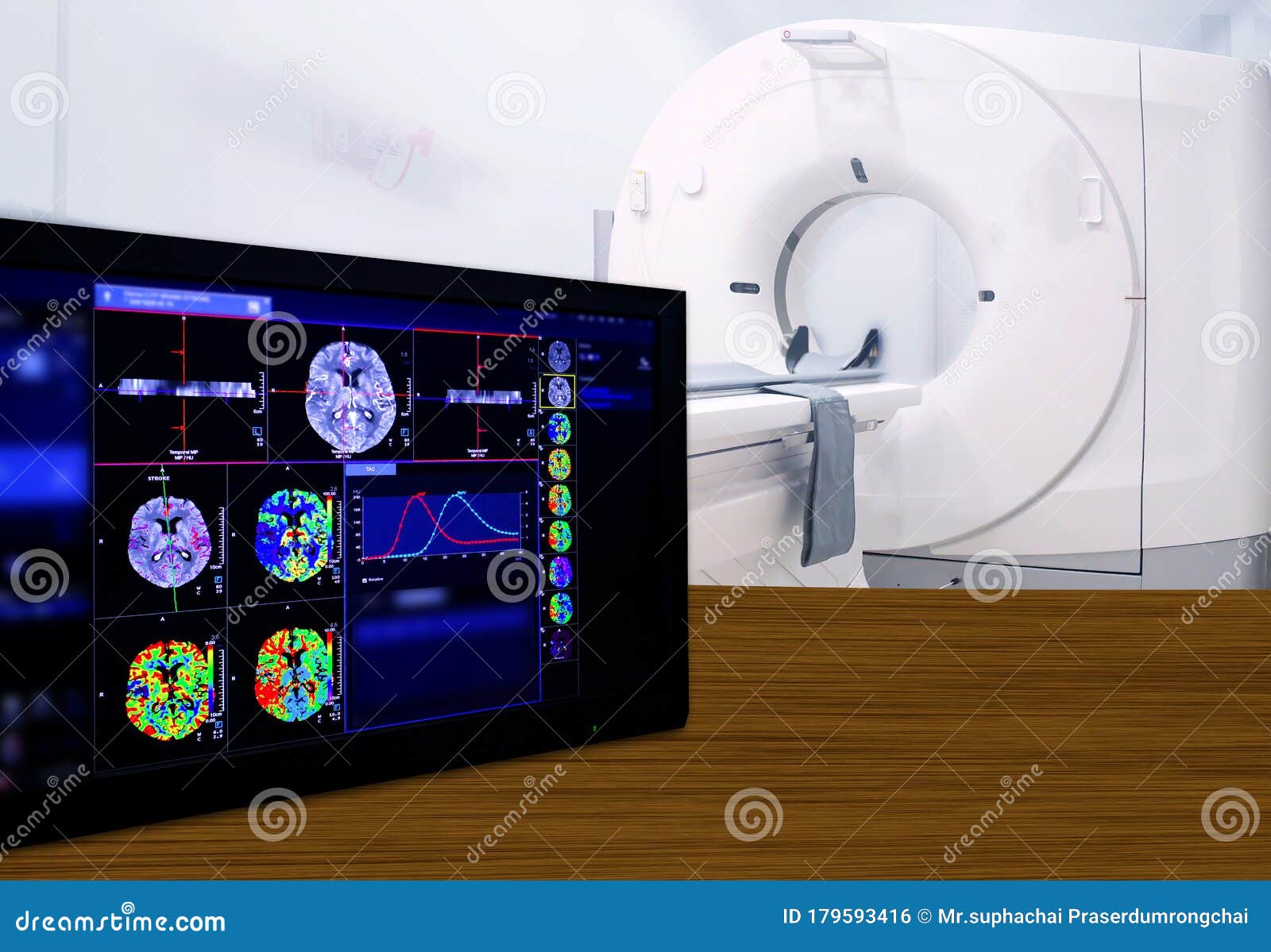 Brain Perfusion or CT Scan of Blood Flow in the Brain 3d Rendering ...