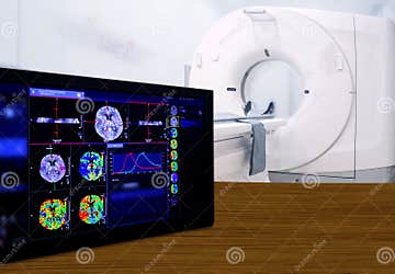 Brain Perfusion or CT Scan of Blood Flow in the Brain 3d Rendering ...