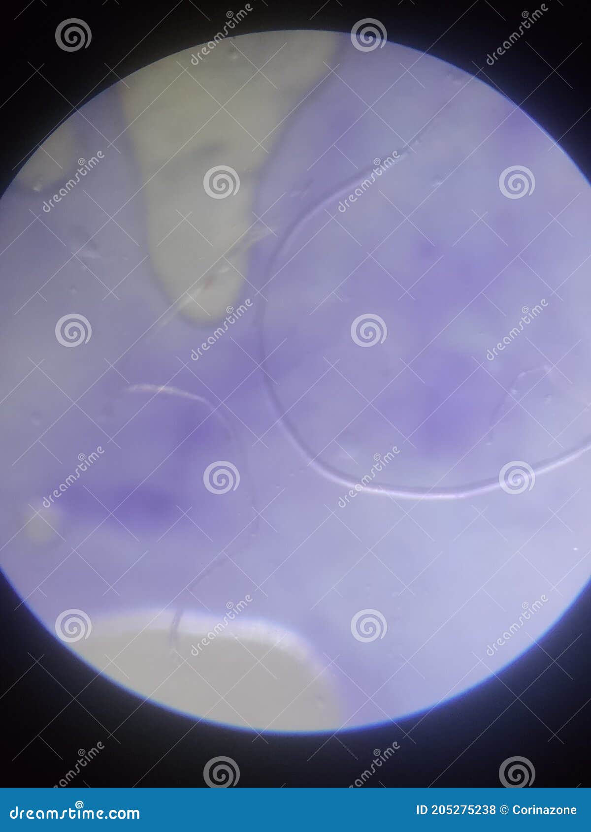 The Brain of a Pig Under the Microscope Stock Photo - Image of meat ...