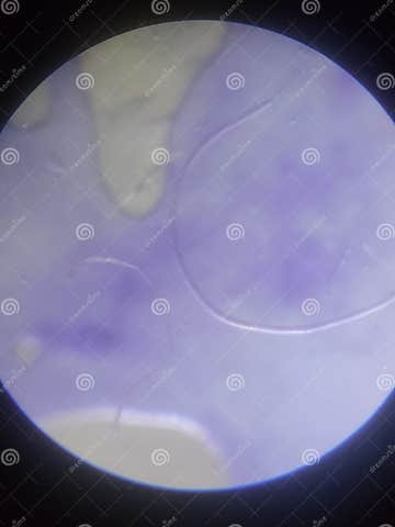 The Brain of a Pig Under the Microscope Stock Photo - Image of meat ...