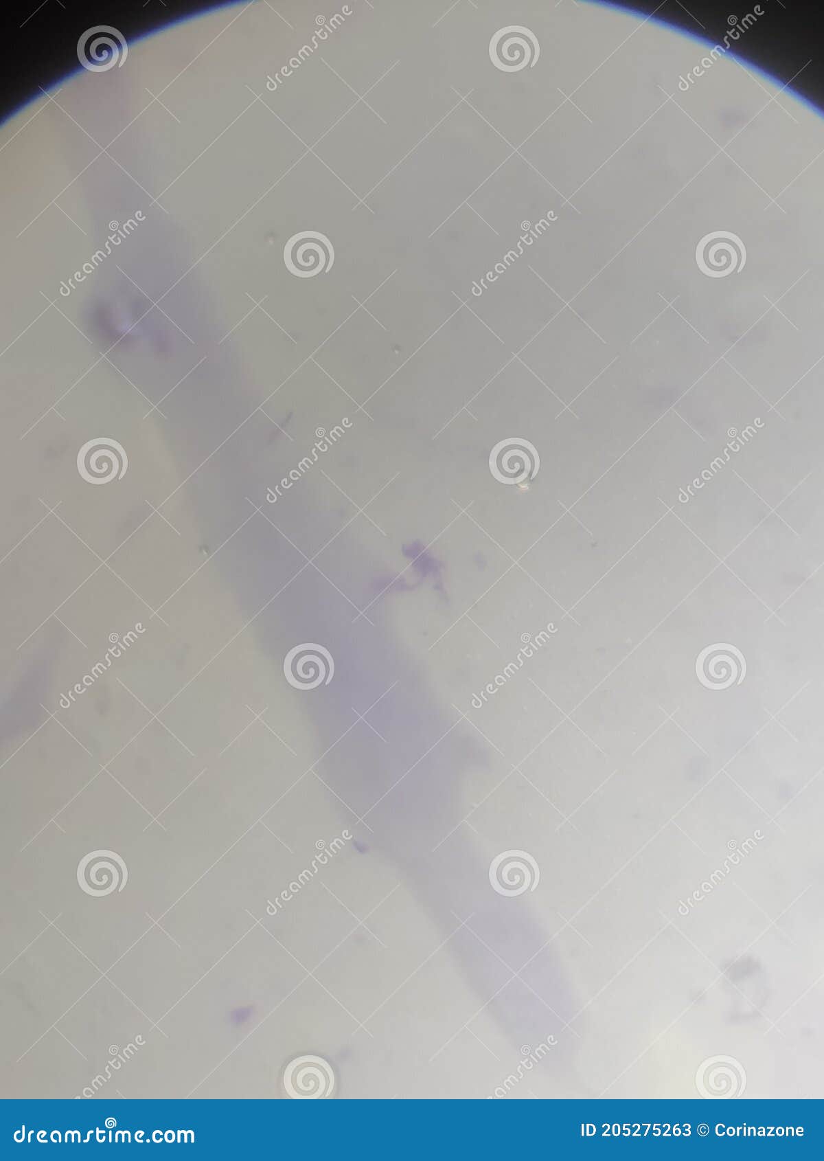 The Brain of a Pig Under the Microscope Stock Image - Image of biology ...