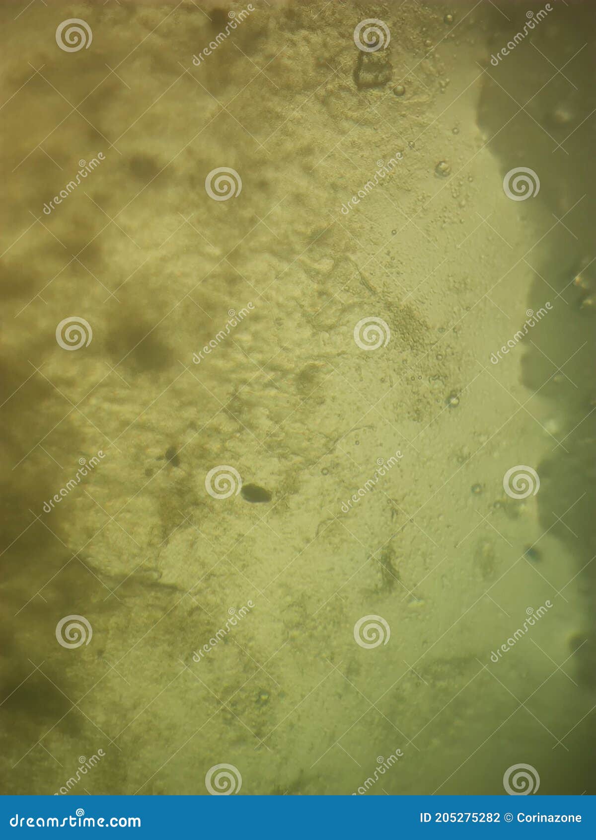 The Brain of a Pig Under the Microscope Stock Photo - Image of ...