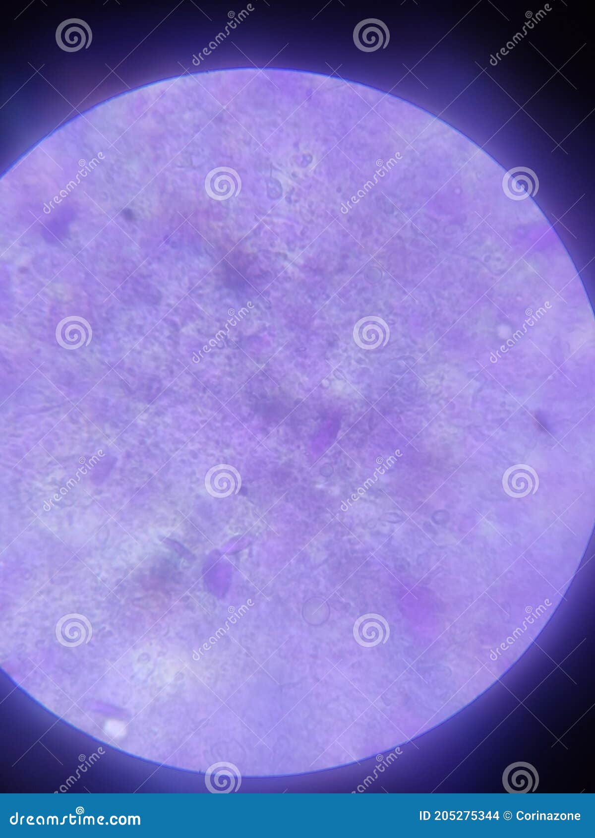 The Brain of a Pig Under the Microscope Stock Photo - Image of cerebral ...