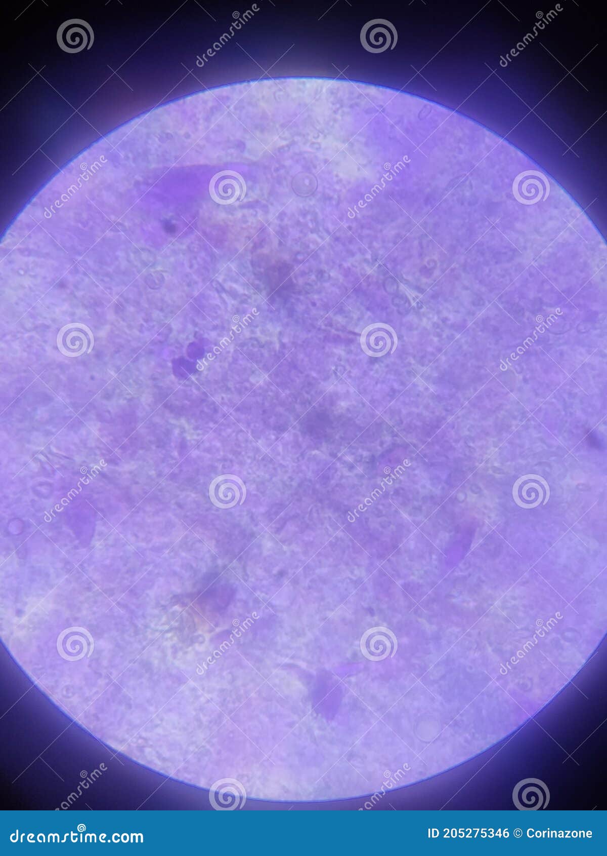 The Brain of a Pig Under the Microscope Stock Photo - Image of pork ...