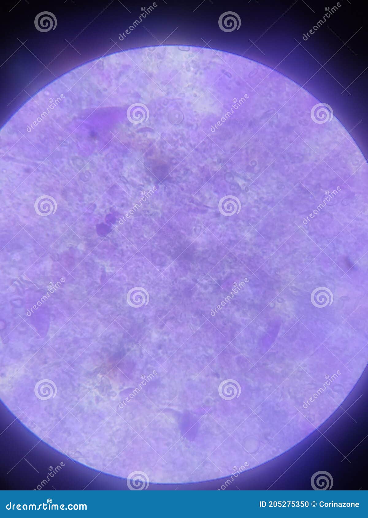 The Brain of a Pig Under the Microscope Stock Photo - Image of view ...