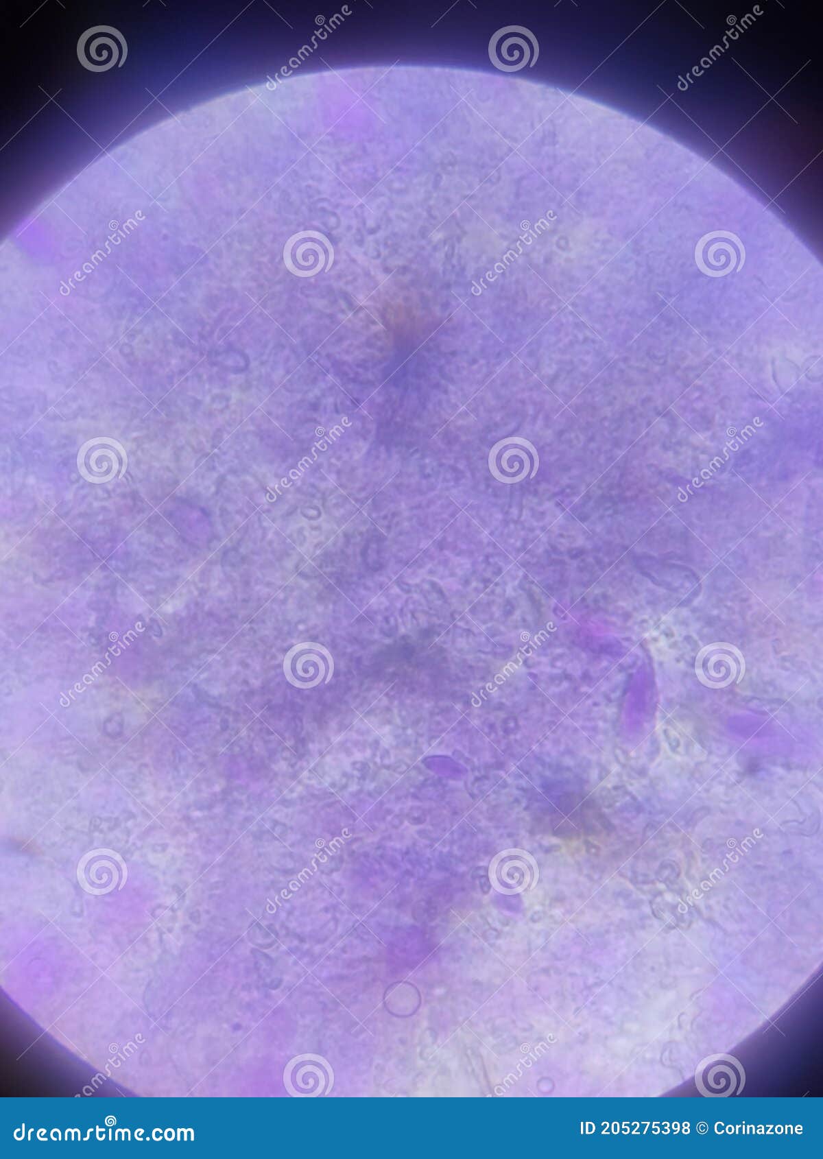 The Brain of a Pig Under the Microscope Stock Photo - Image of ...