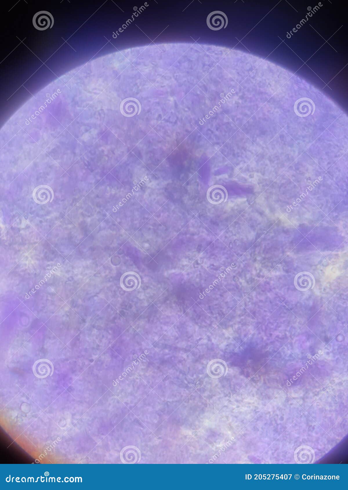 The Brain Of A Pig Under The Microscope Royalty-Free Stock Photography ...