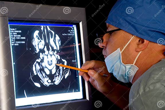 Brain Scan stock image. Image of clinical, hospital, male - 10489617