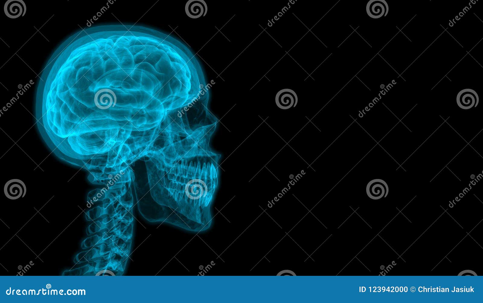 Brain Scan Xray - 2018 stock illustration. Illustration of blue - 123942000