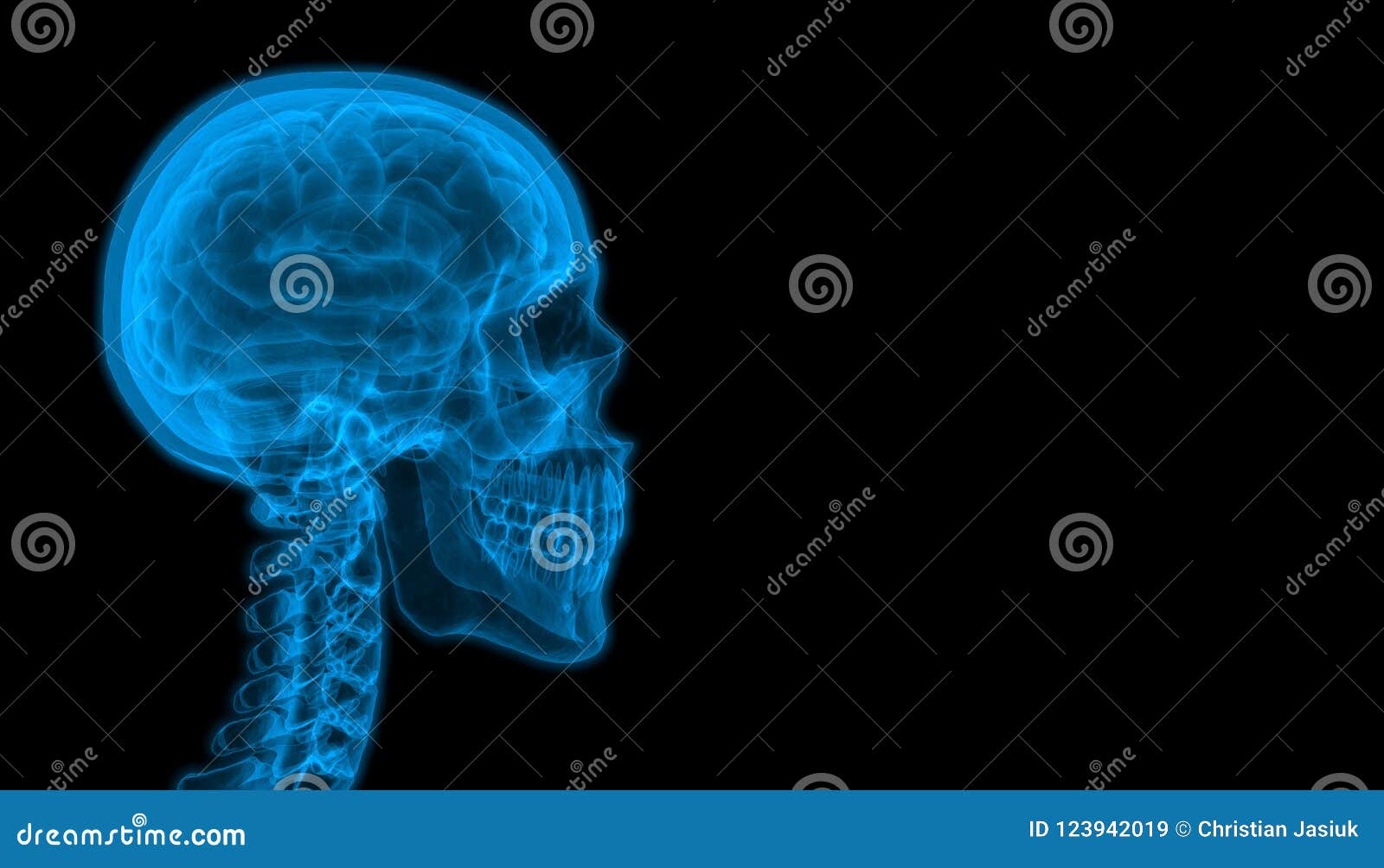 Brain Scan Xray Redux Blue - 2018 Stock de ilustración - Ilustración de ...