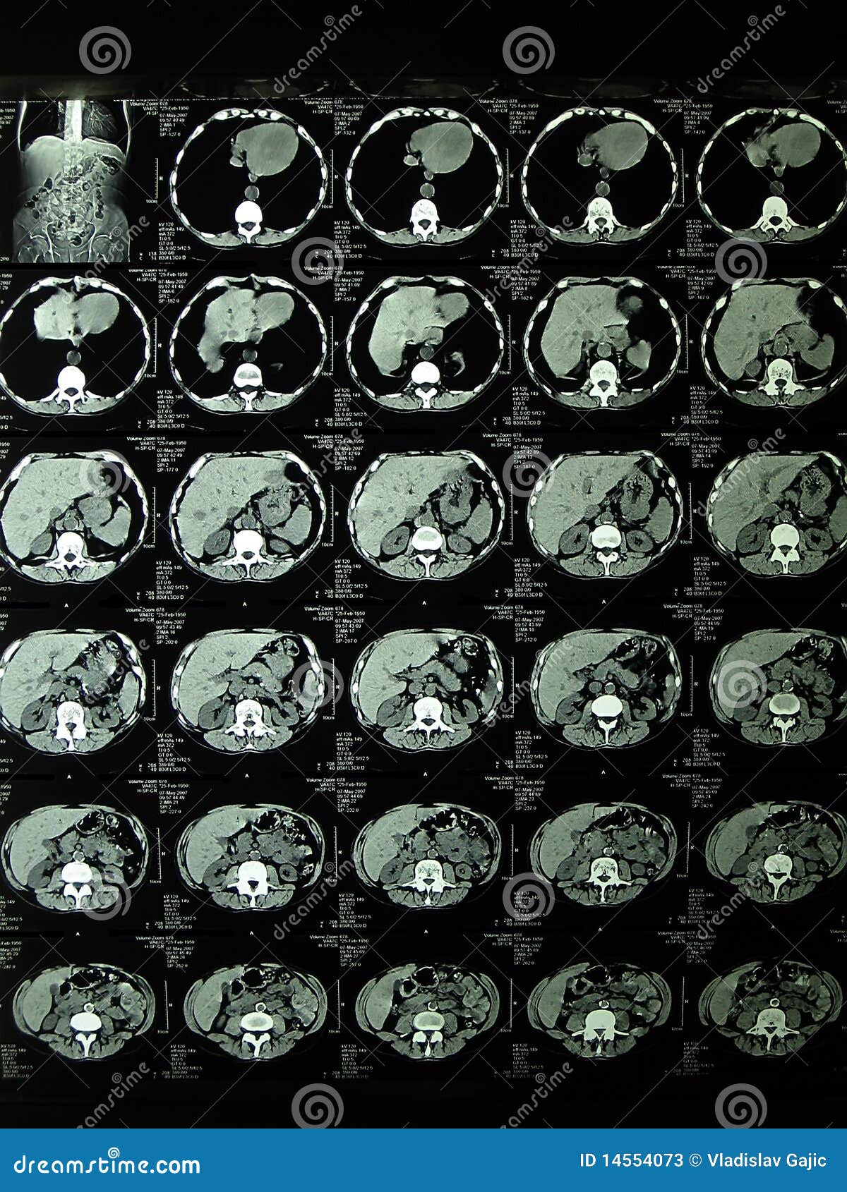 3,100 Brain Scanner Photos - Free & Royalty-Free Stock Photos from ...