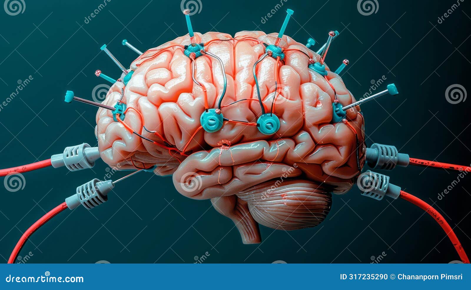 Brain Stimulation. Conceptual Image Stock Illustration - Illustration ...