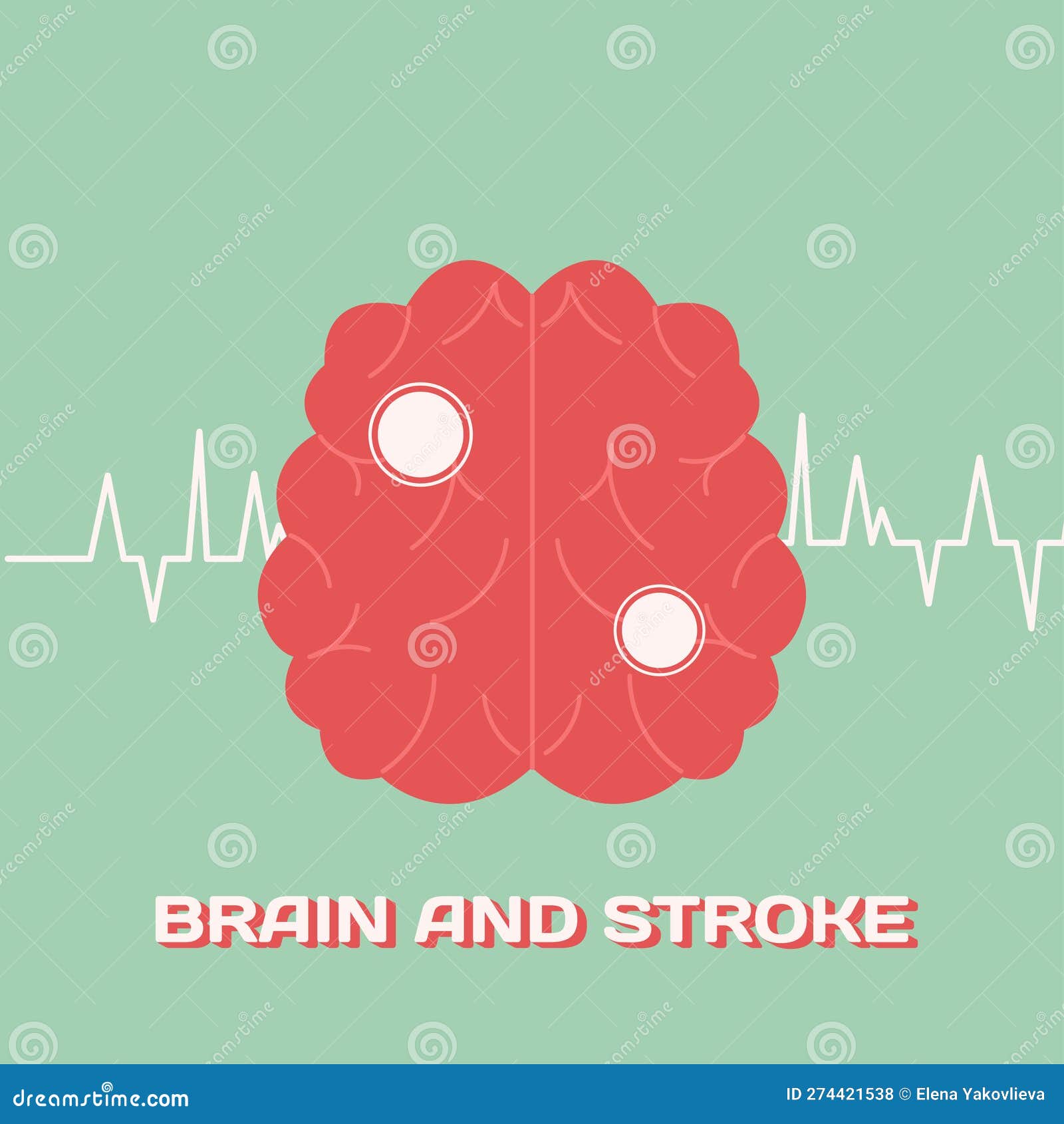 Brain and Stroke Concept Illustration in Flat Style Stock Illustration ...