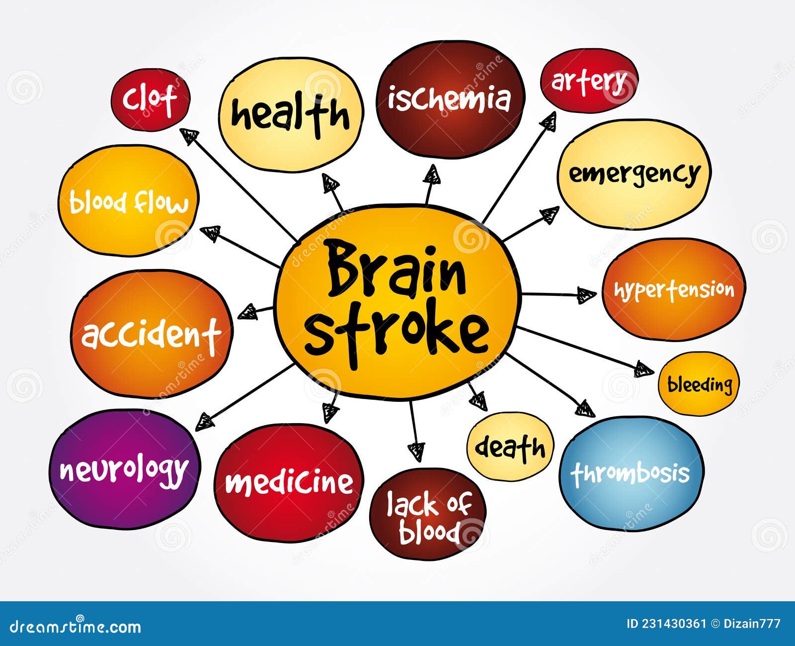 Brain Stroke Mind Map, Medical Concept for Presentations and Reports Stock Illustration ...