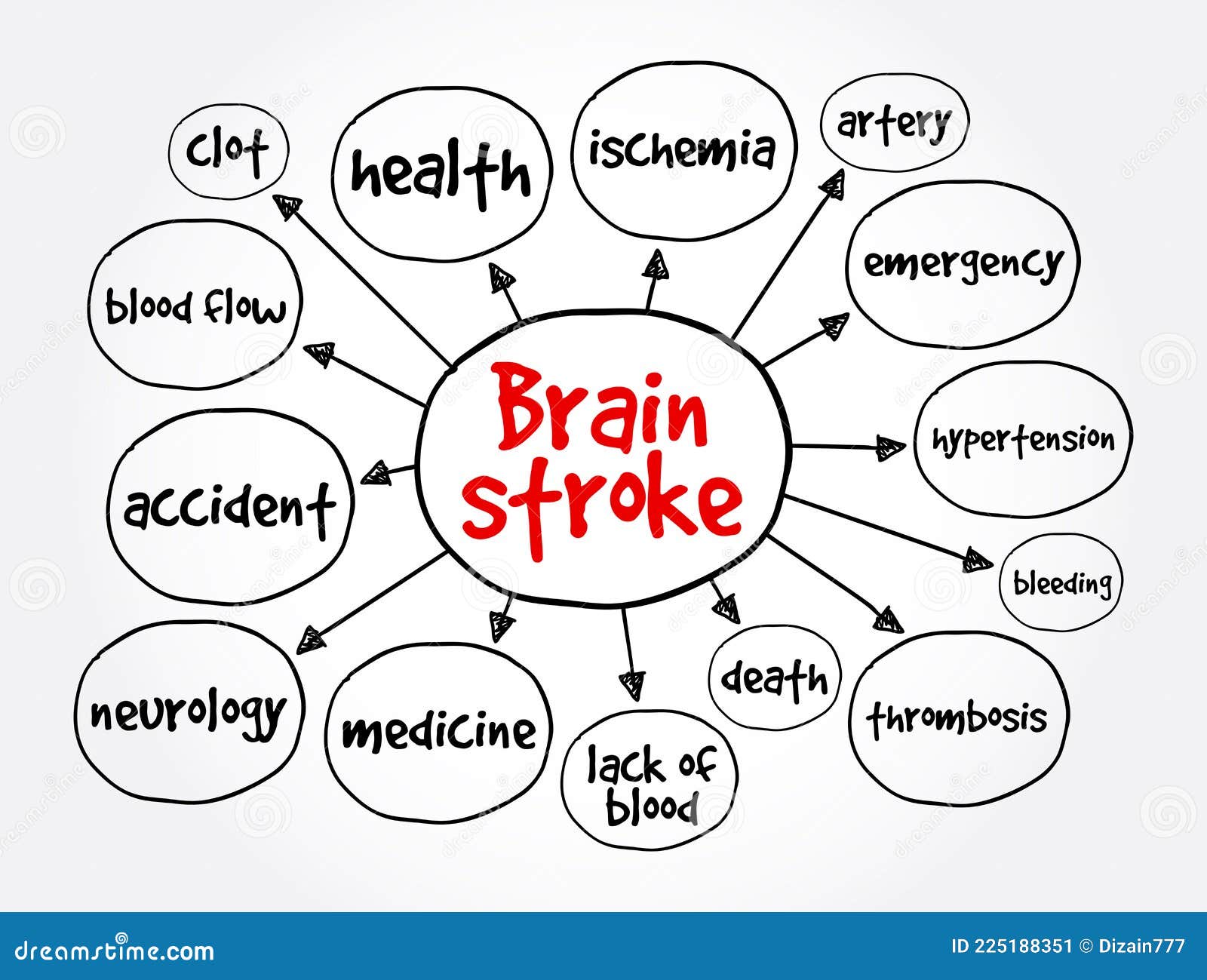 Brain Stroke Mind Map, Medical Concept for Presentations and Reports Stock Illustration ...