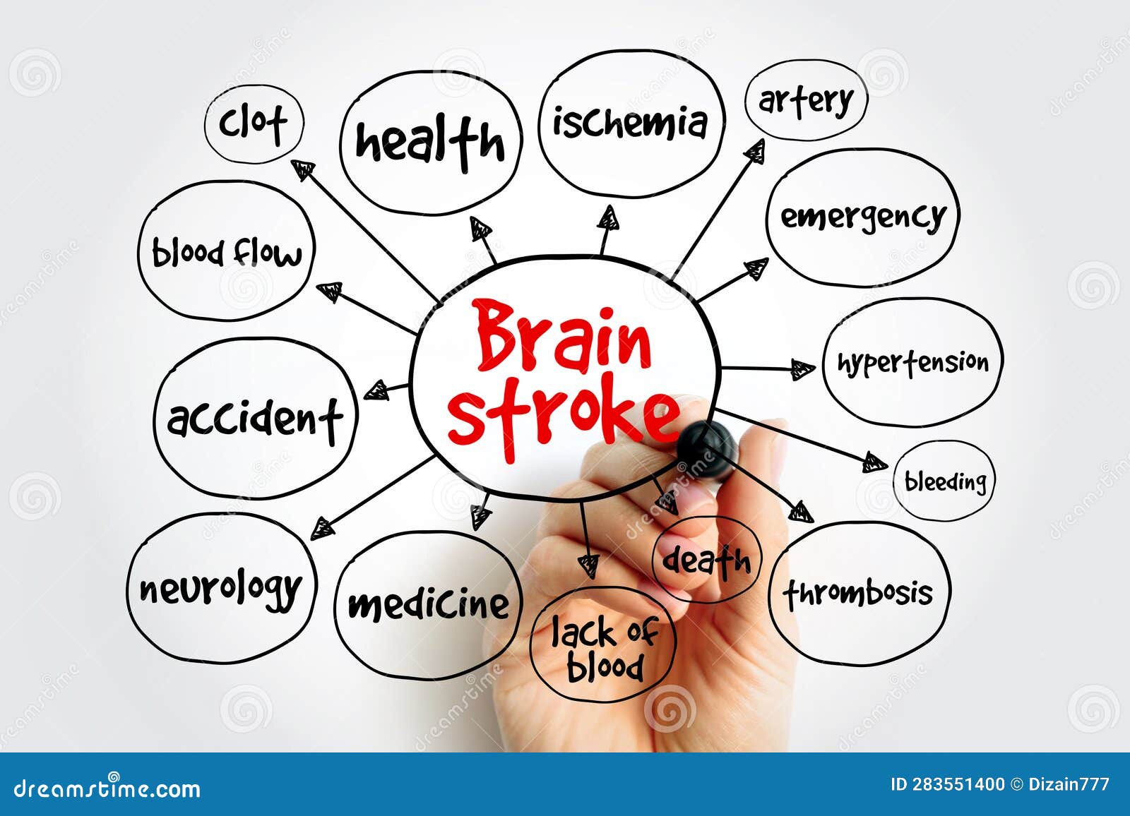 Brain Stroke Mind Map, Medical Concept for Presentations and Reports ...