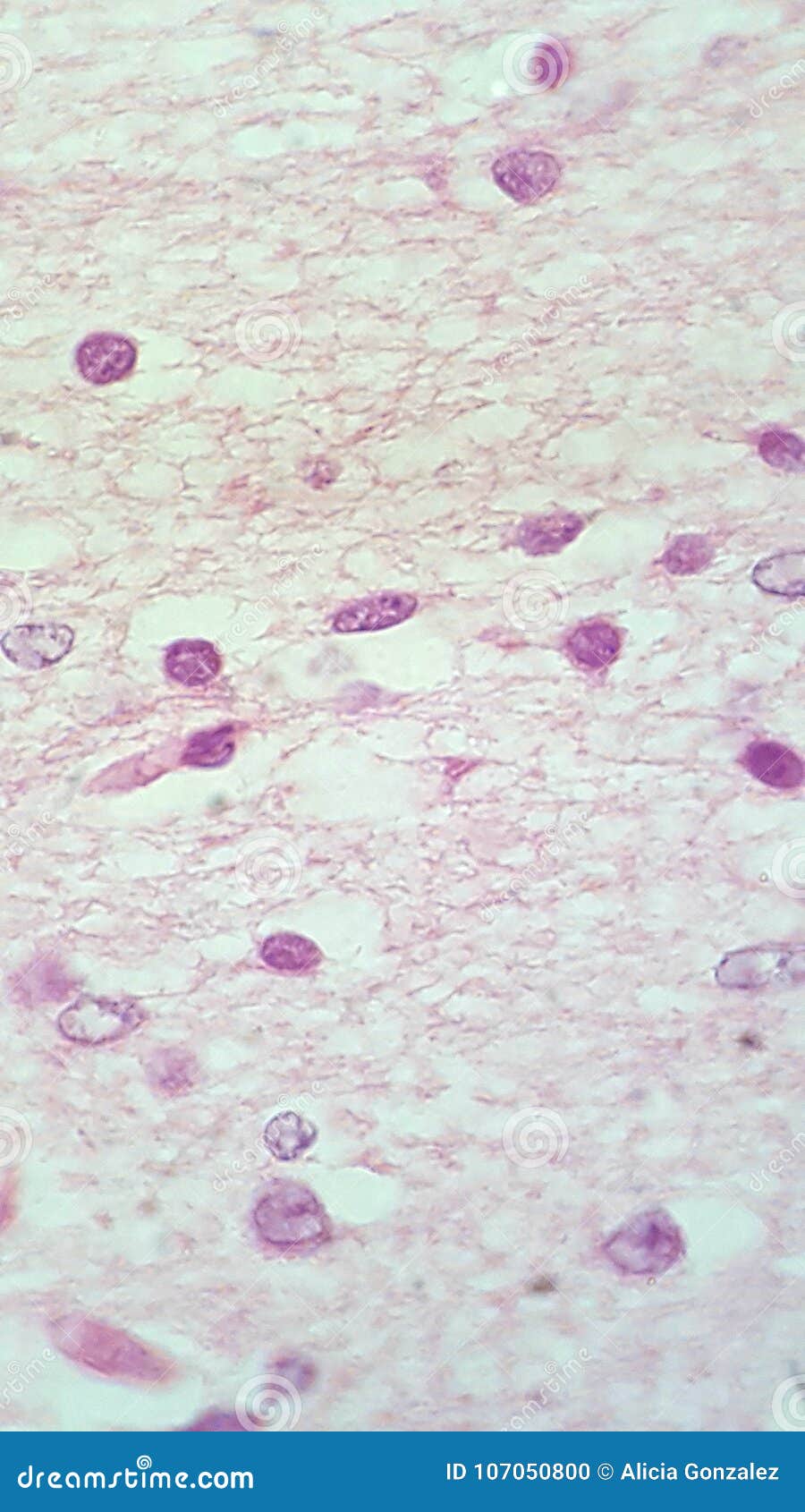 Human Brain Tissue Microphotography Under Optic Microscope at 1000x ...