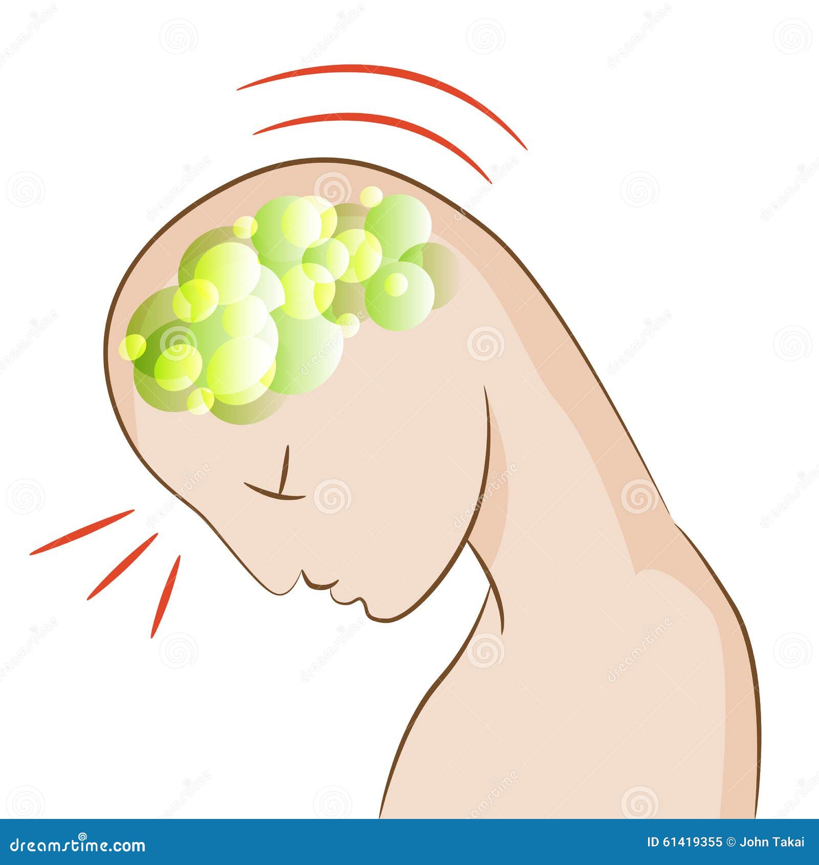 Brain Trauma Man stock vector. Illustration of graphic - 61419355