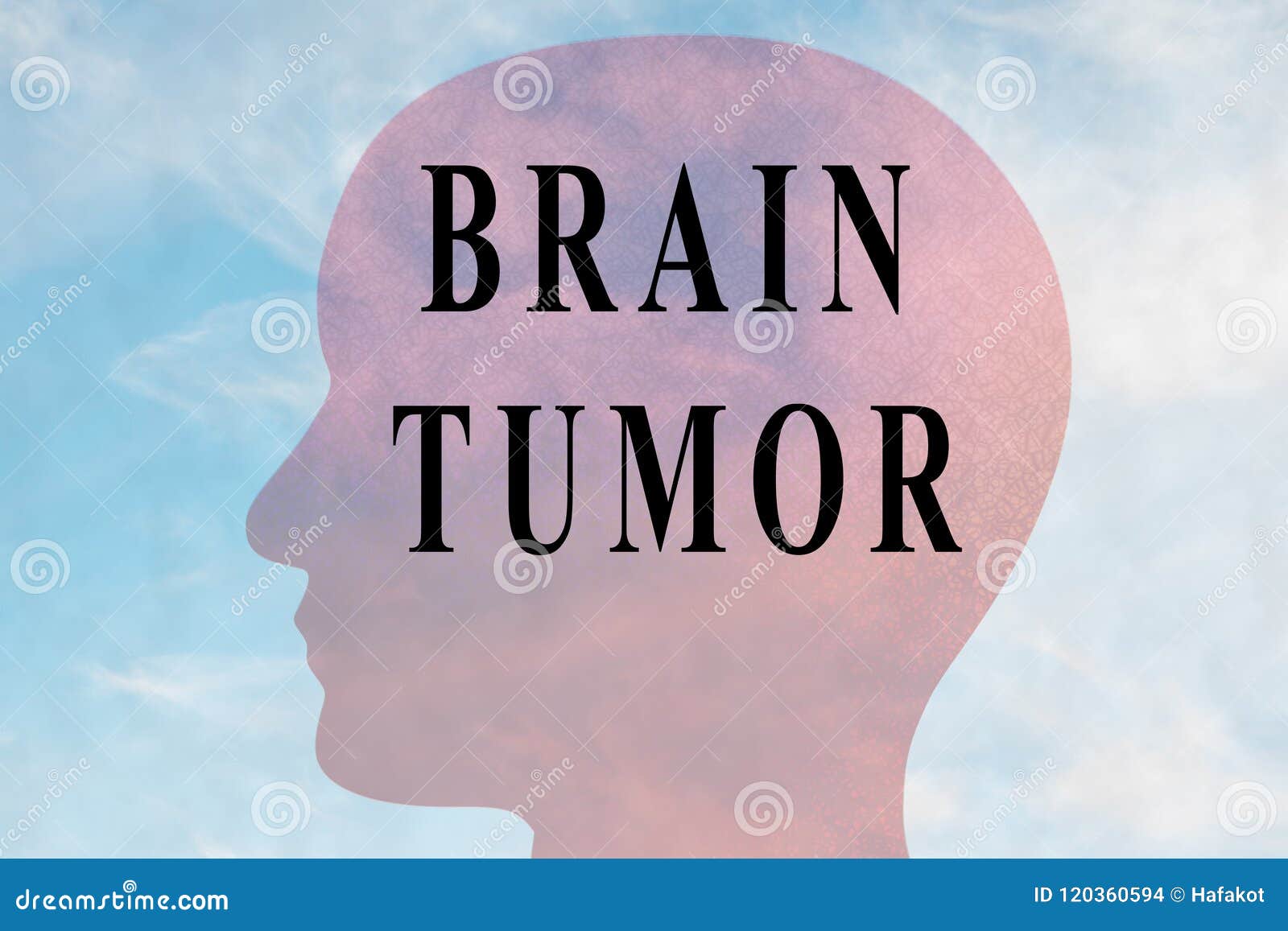 BRAIN TUMOR concept stock illustration. Illustration of organ - 120360594