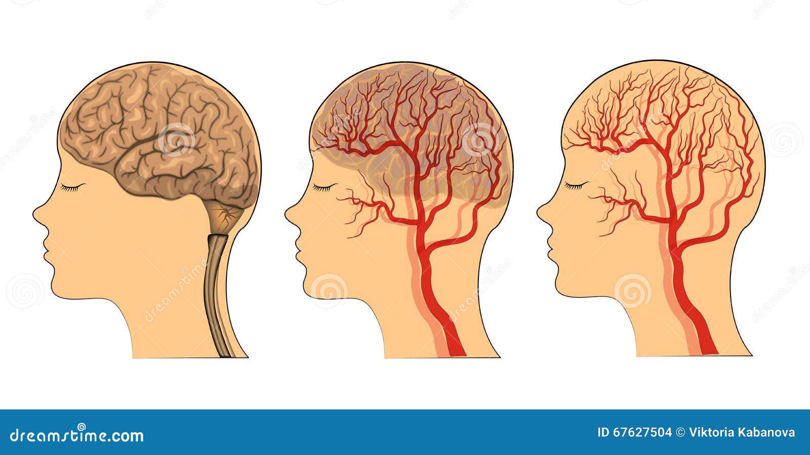 Cerebral Perfusion Stock Illustrations – 51 Cerebral Perfusion Stock ...